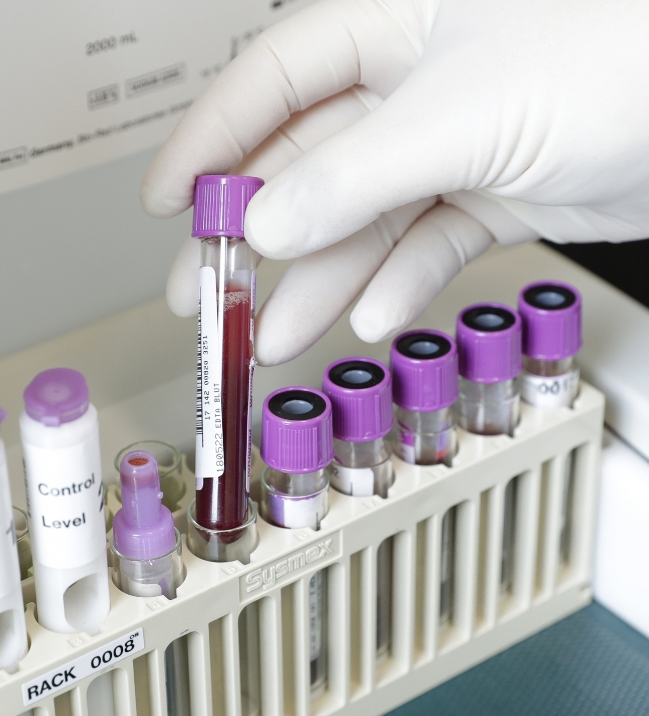 Labordiagnostik - Wiener Gesundheitsverbund - Klinik Favoriten